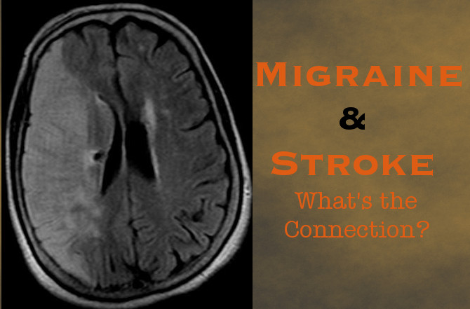 Migraine And Stroke Whats The Connection And Should You Worry About It My Migraine Miracle