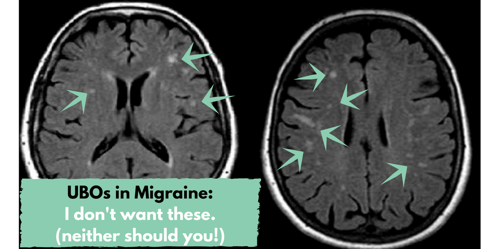 The Gluten & Migraine Connection: What You Need To Know The Gluten & Migraine Connection: What You Need To Know
